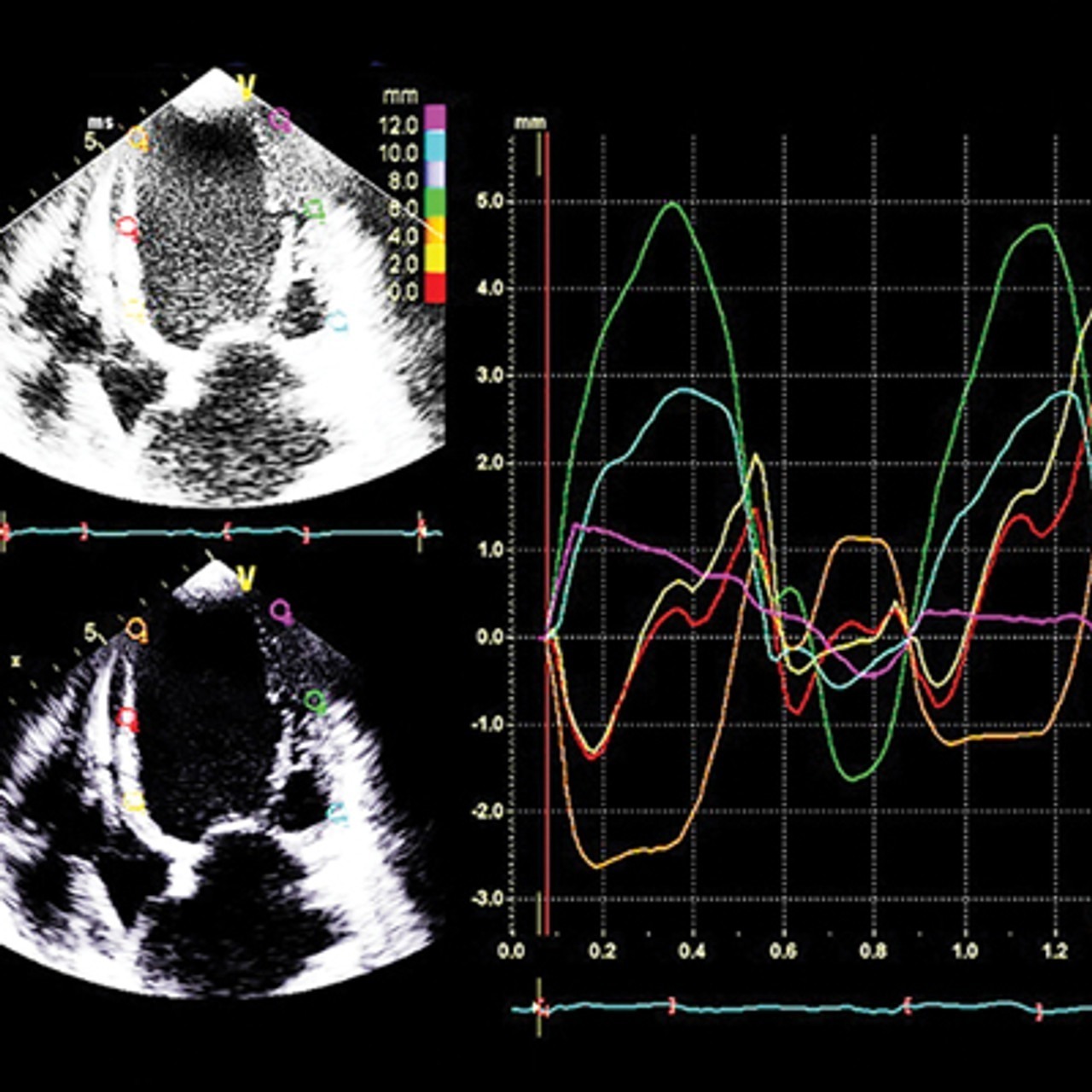 Echocardiography: A Comprehensive Review 2022 - MedicalBooksVN